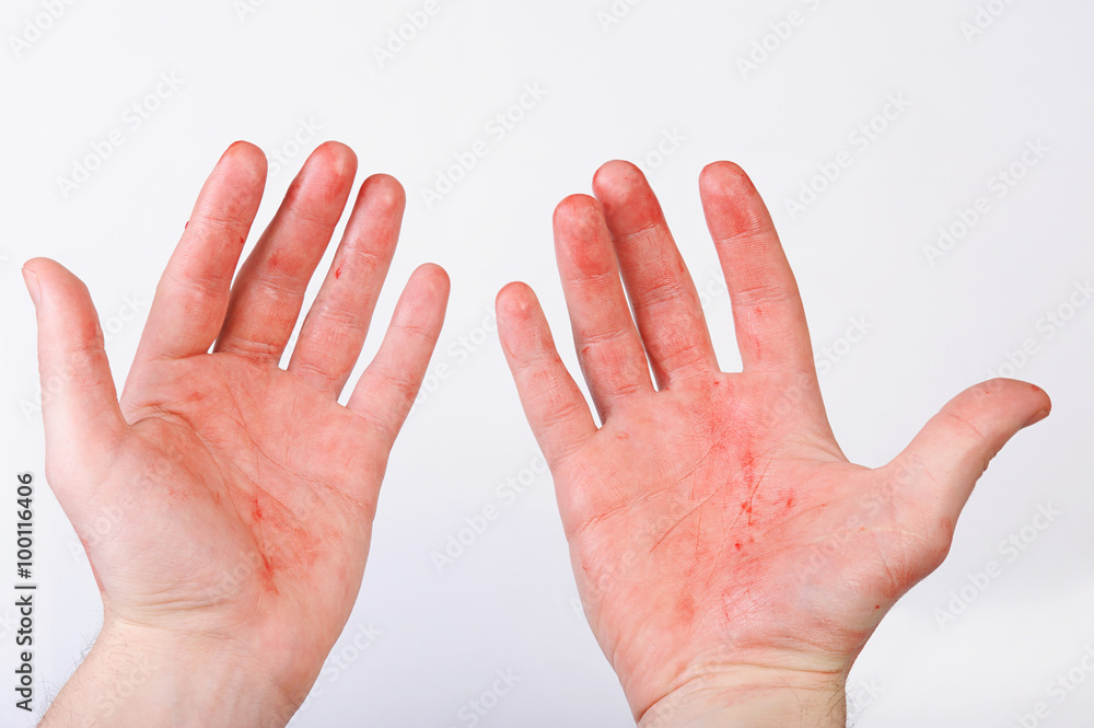 blood on hands Stock Photo | Adobe Stock