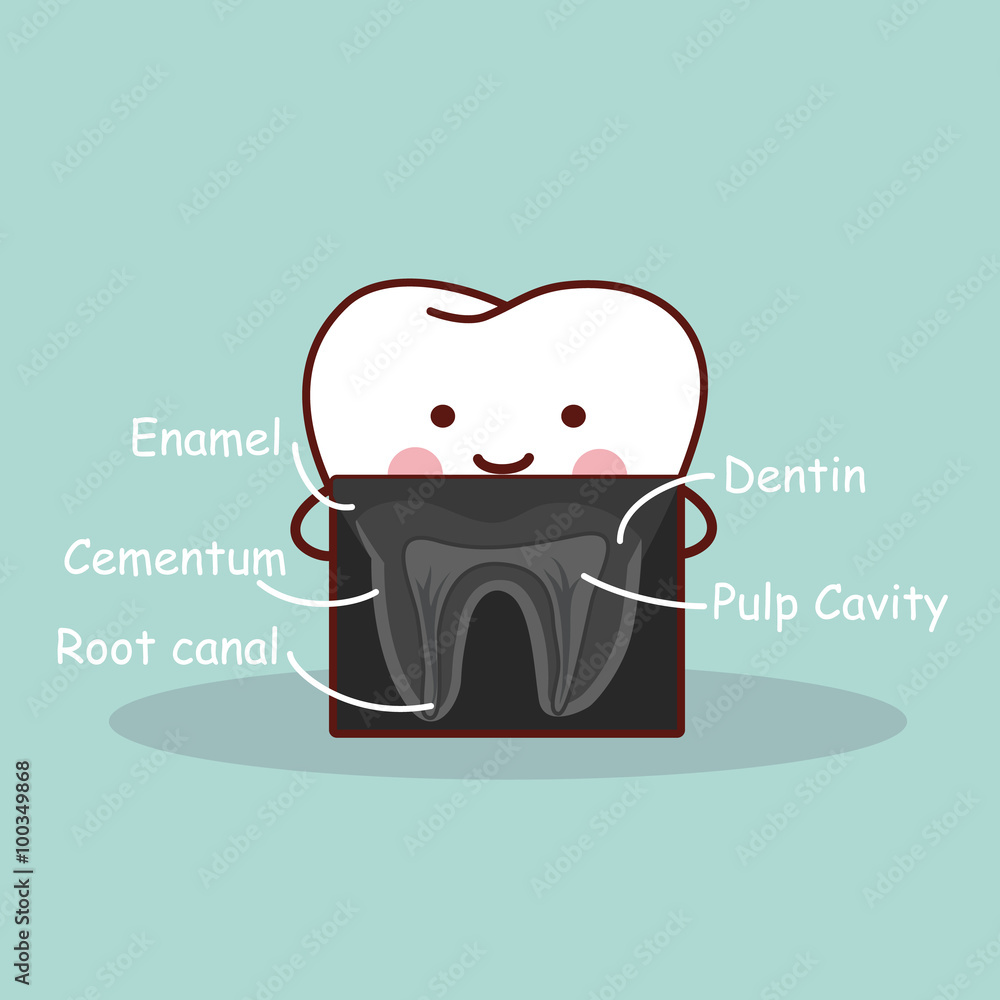 cartoon tooth with X ray Stock Vector | Adobe Stock