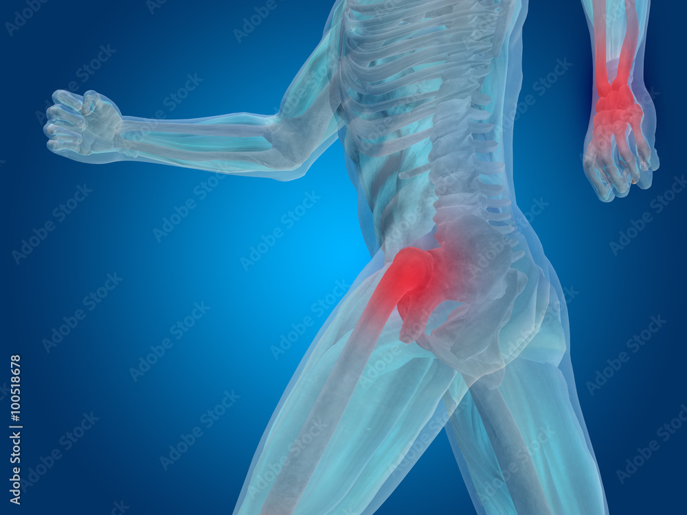 Conceptual human body anatomy pain on blue Stock Illustration | Adobe Stock