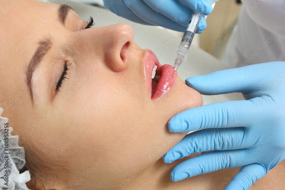 Beautiful woman gets an injection in her lips. Stock Photo | Adobe Stock