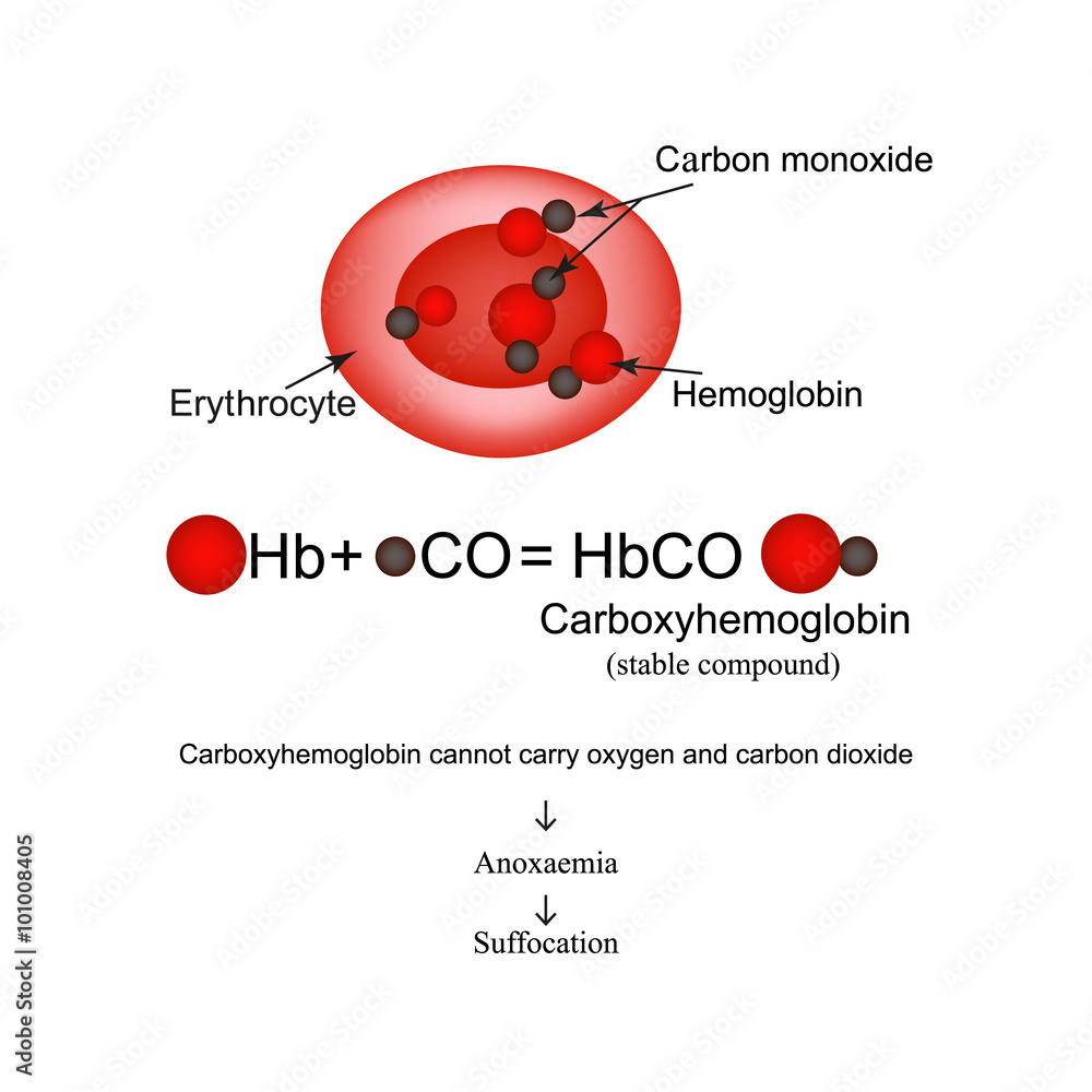 Carboxyhemoglobin. Joining the hemoglobin carbon monoxide. Carbon monoxide poisoning ...