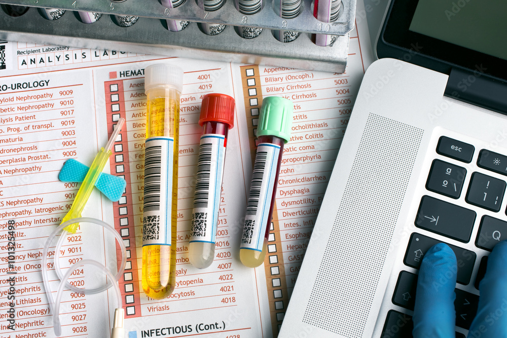 top view of a work table of lab with test tubes for analysis /flat lay ...