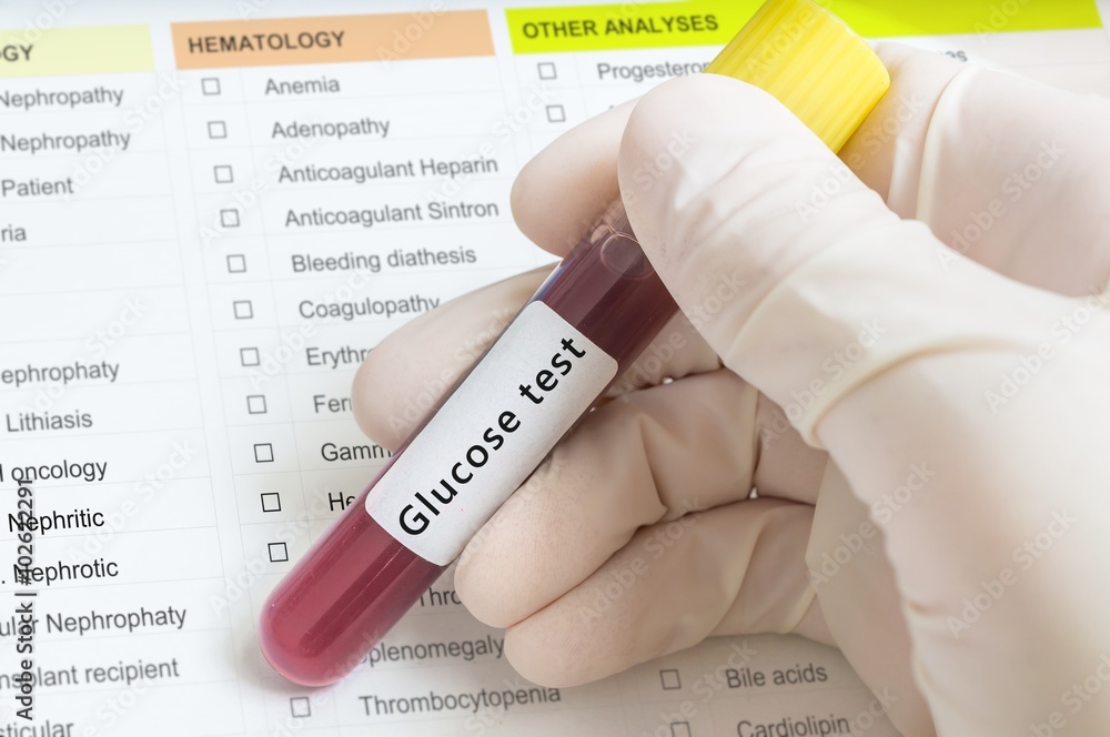 Hand holds test tube with blood for Glucose test to recognize diabetes ...