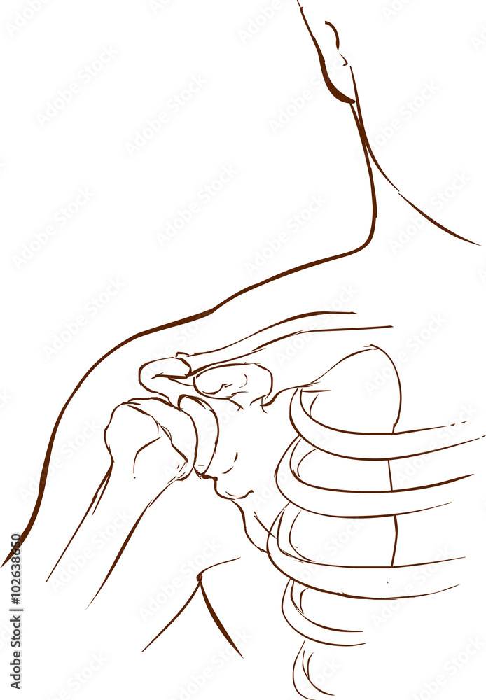 white background vector illustration of a shoulder dislocation Stock ...