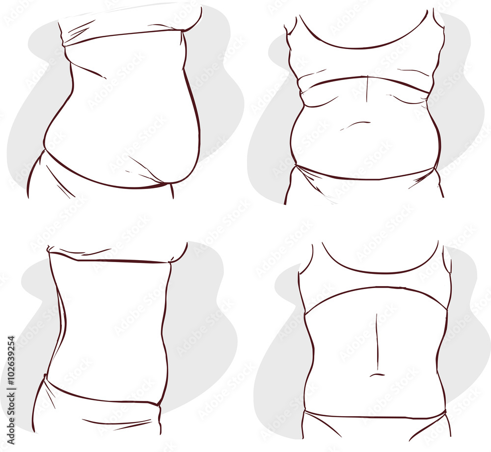 vector illustration of a Fat belly before and after treatment. Stock ...