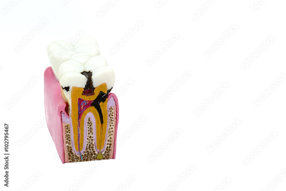 Big tooth model with details on the nerve, dentin, enamel, dental ...