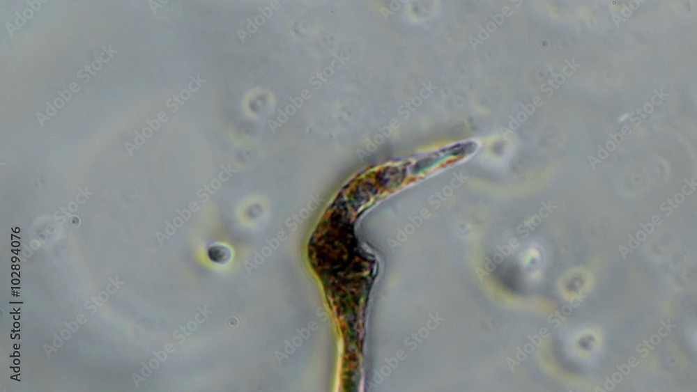 Nematode Worm Stretches Body While Swimming Under Microscope 400x Stock ...
