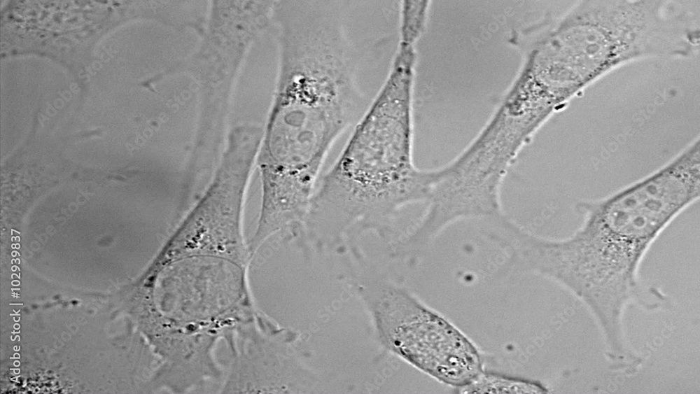 Movement, division and death of HeLa cervical cancer cells under ...