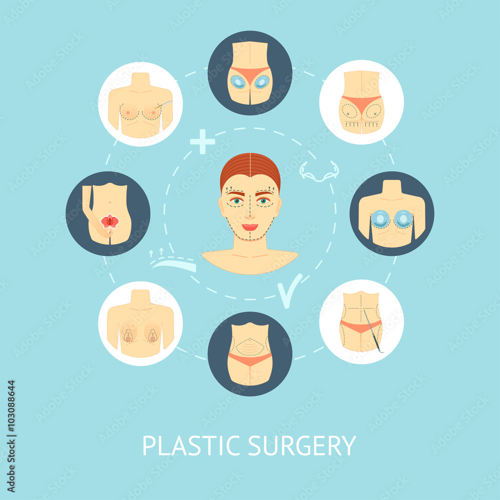 Plastic surgery flat icon set. Plastic surgery banner, background ...