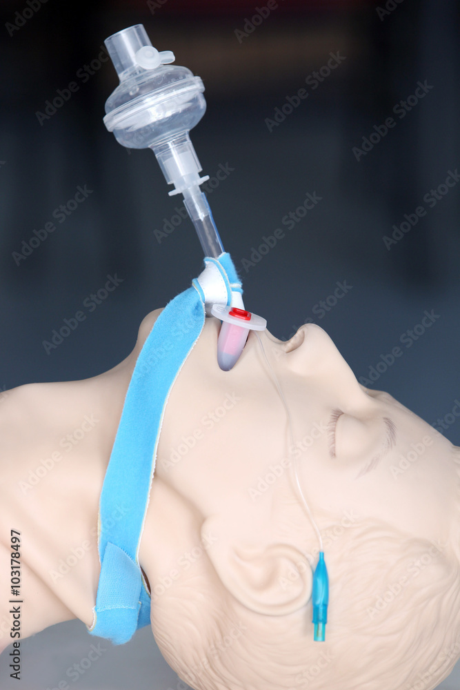 Foto de Tracheal intubation open the airway do Stock | Adobe Stock