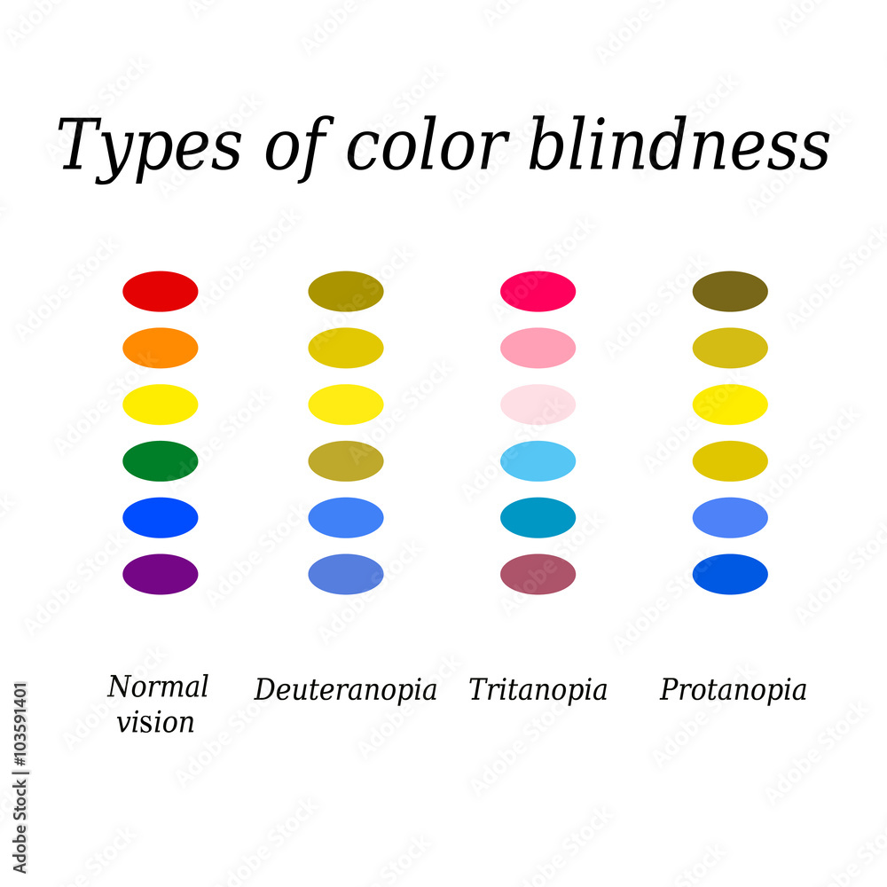 Types of color blindness. Eye color perception. Vector illustration on ...