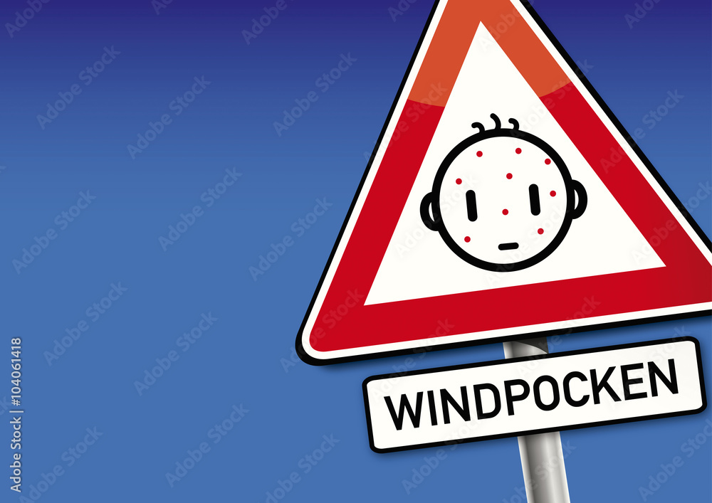 Achtung Windpocken Stock Vector | Adobe Stock