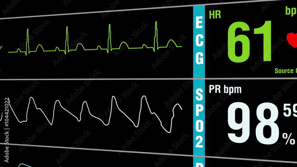 Patient monitor displays vital signs ECG electrocardiogram EKG, oxygen ...