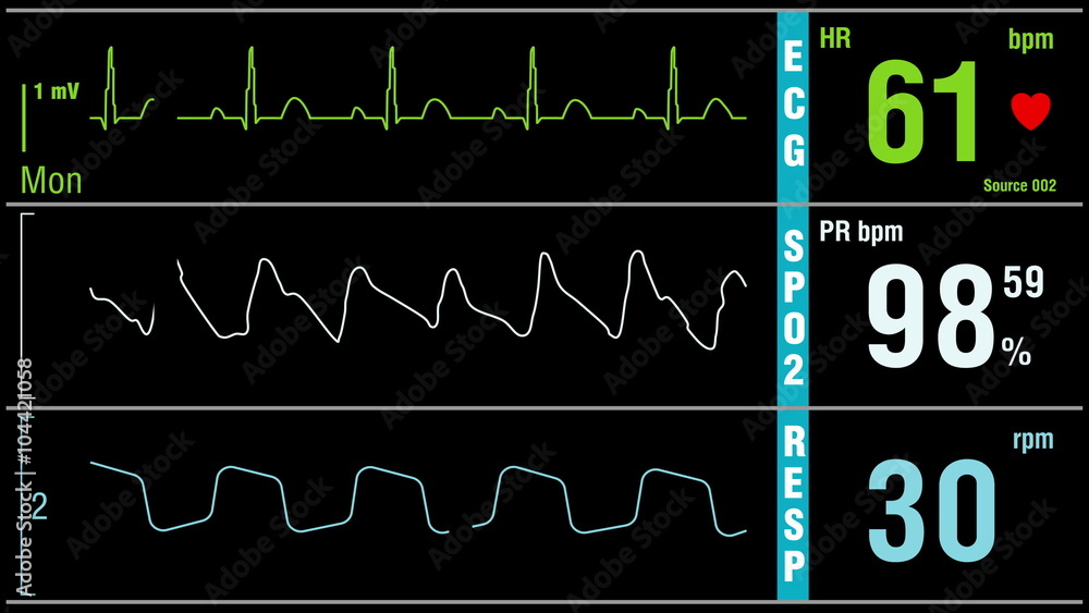 Looped: Patient monitor displays vital signs ECG electrocardiogram EKG ...