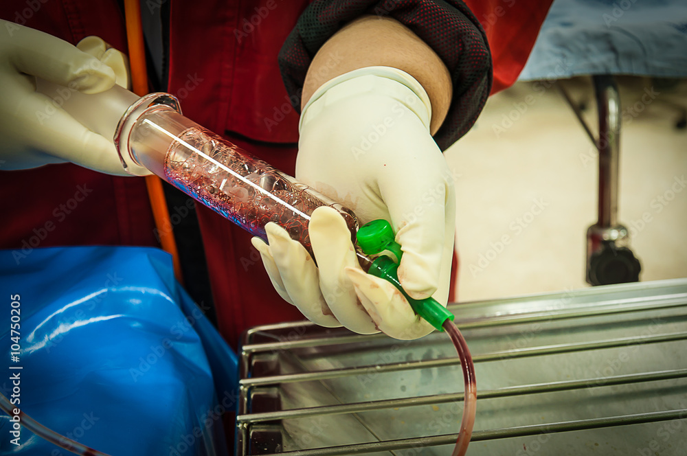 nasogastric tube use for treatment and diagnosis in upper ...