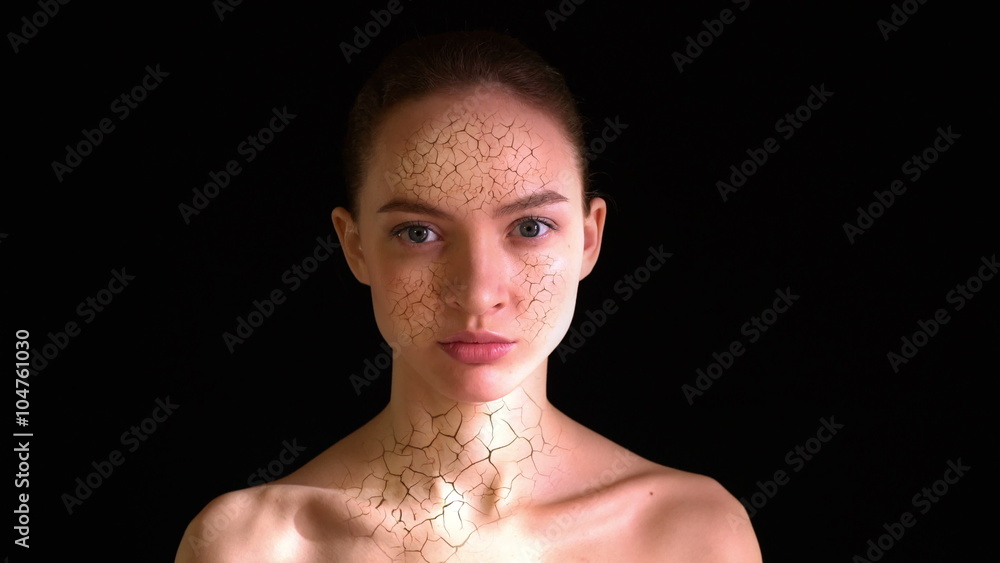 Dry Skin. Girl with dry skin on the face and neck turns into a ...