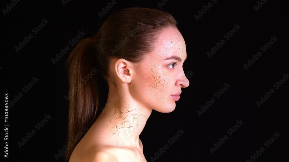 Dry Skin. Girl with dry skin on the face and neck turns into a ...