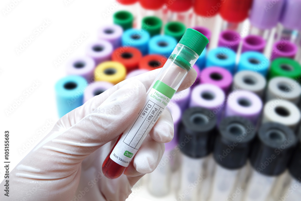 Lithium Heparin blood collection tube,with green plastic stopper Stock ...