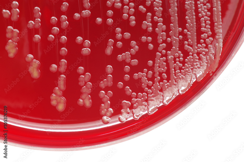 Staphylococcus aureus bacterial colonies on blood agar plate Stock ...