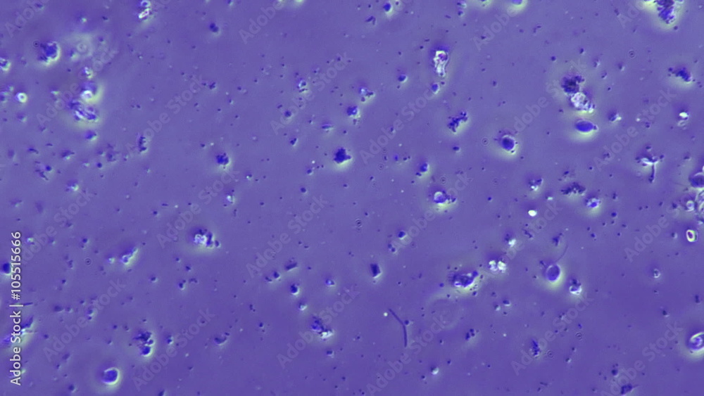 Bacteria Flagellum Swimming In Phase Contrast Microscope at 800x ...