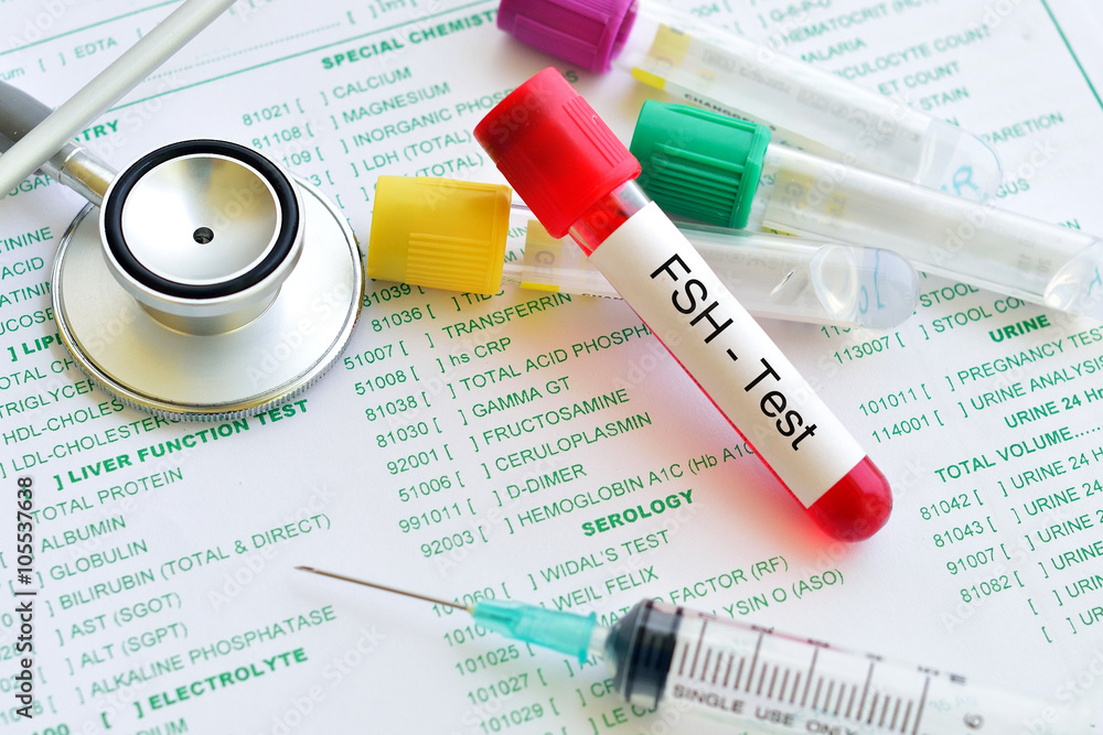 Test tube with blood sample for follicle stimulating hormone (FSH) test ...