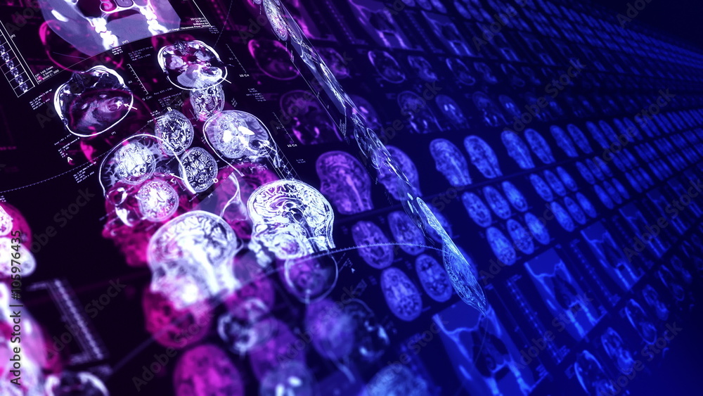 Medical, clinical background. CT scans, X-ray computed tomography of ...