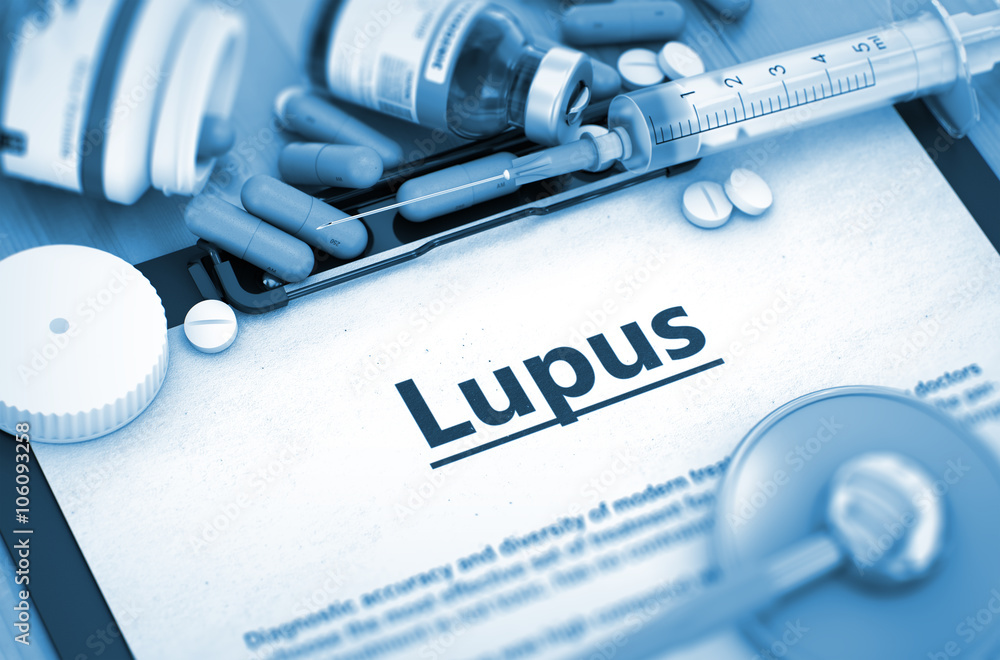 Lupus - Medical Report with Composition of Medicaments - Pills ...