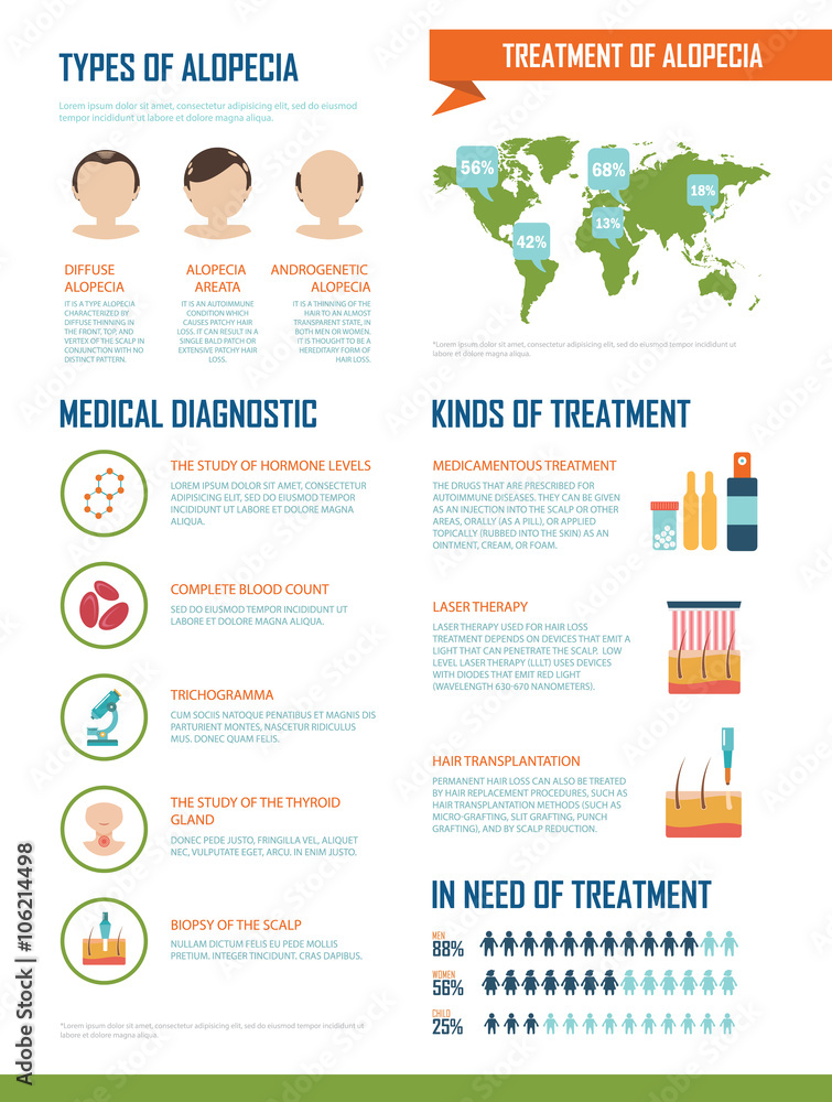 Vector infographics about the treatment of alopecia. Diagnostics and ...