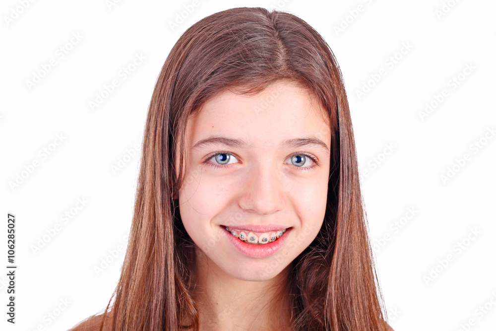 Beautiful young teen girl with brackets on teeth in white Stock Photo ...