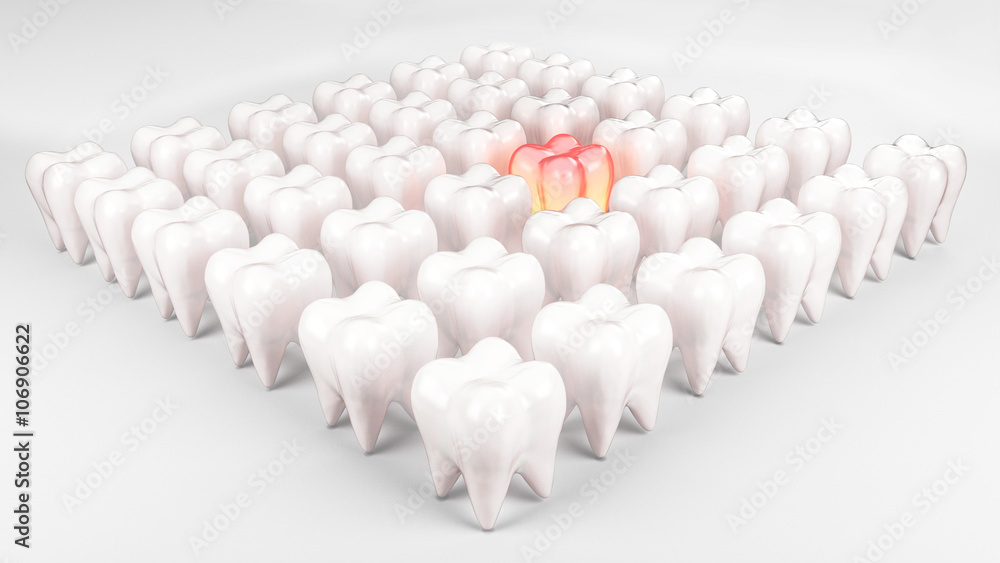 Tooth, aching tooth among healthy, that stands out from the rest ...