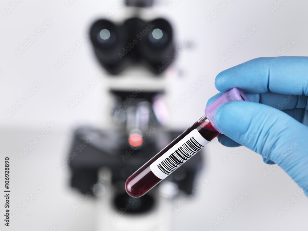 Laboratory scientist holding a blood sample with a upright compound ...
