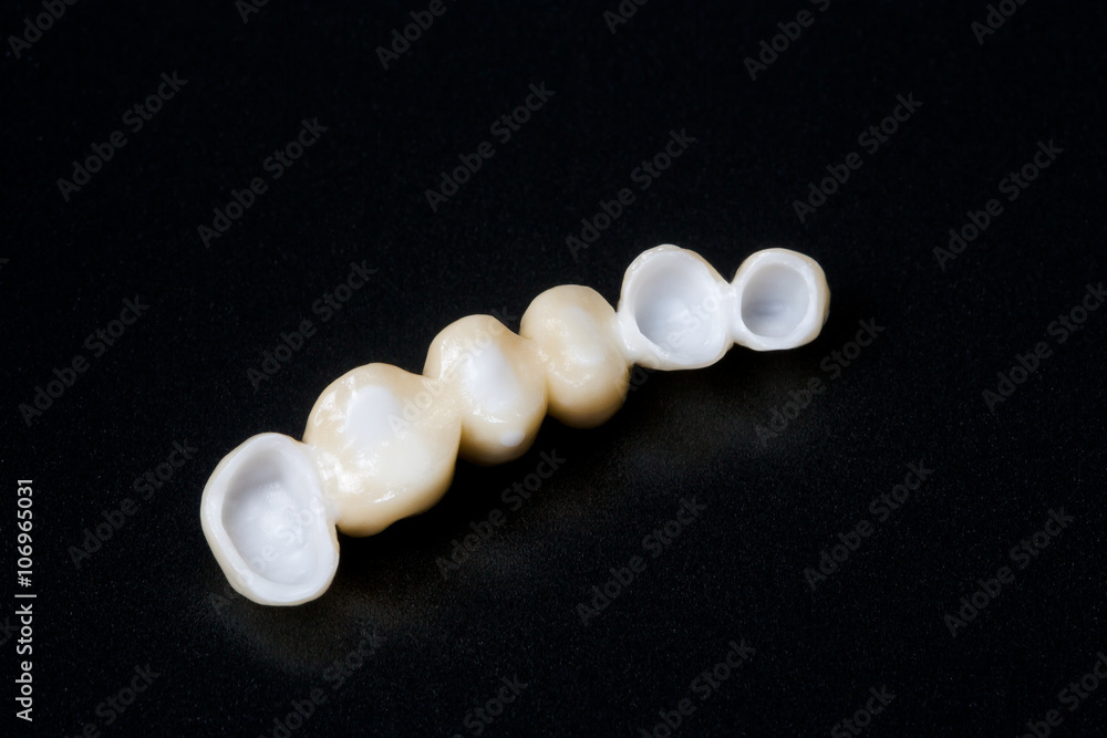 Estructura de zirconio Stock Photo | Adobe Stock