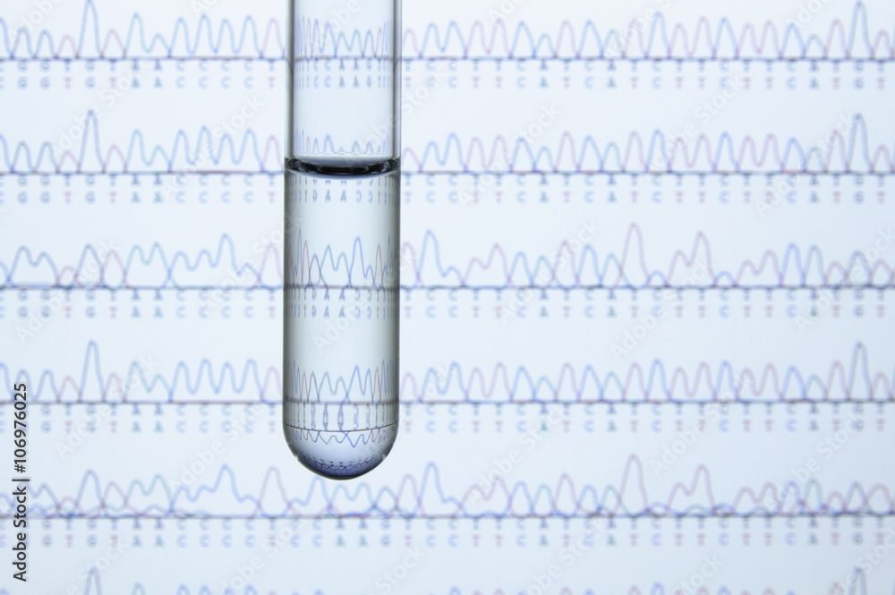 Test tube containing liquid with computer monitor displaying results of ...