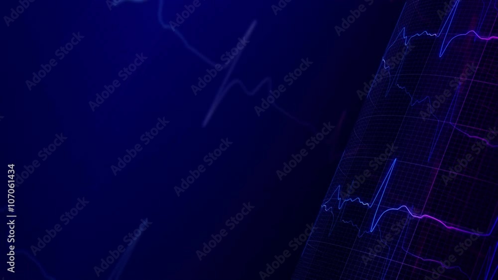 Heart rate, electrocardiogram, ECG medical background. LOOP. Stock ...