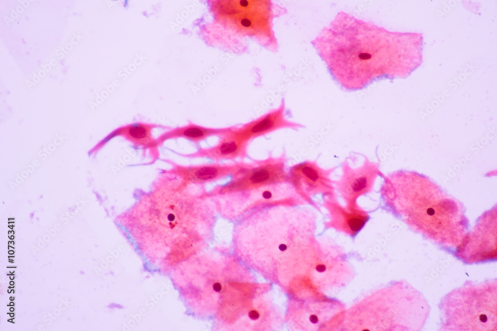 Human cells view in microscopy.Squamous metaplastic cells from pap ...