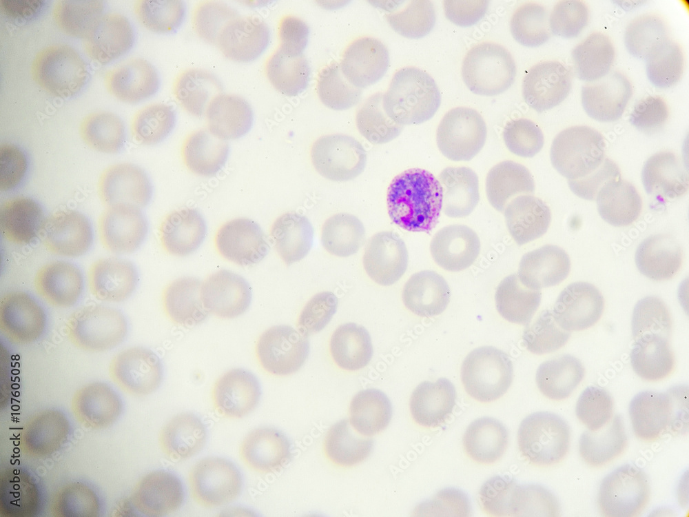 Plasmodium Malariae Gametocyte