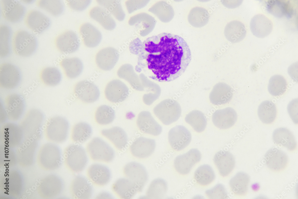 Monocyte cell in blood smear Stock Photo | Adobe Stock