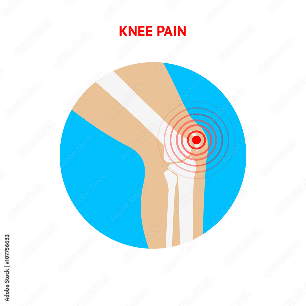 Knee pain. Knee pain icon isolated on white background. Stock Vector ...