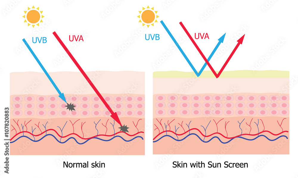 Infographic about sunscreen lotion protect human skin from UVA , Stock ...