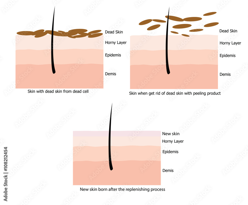 Skin replinished the new one after the peel the dead skin Stock Vector ...