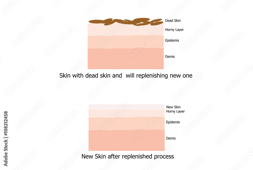 Skin replinished the new one after the peel the dead skin Stock Vector ...