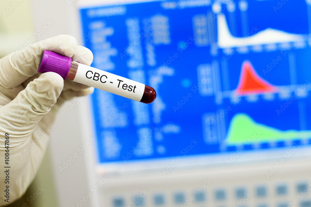 Blood Sample For Complete Blood Count CBC Test Stock Photo Adobe Stock blood-sample-for-complete-blood-count-cbc-test-stock-photo-adobe-stock