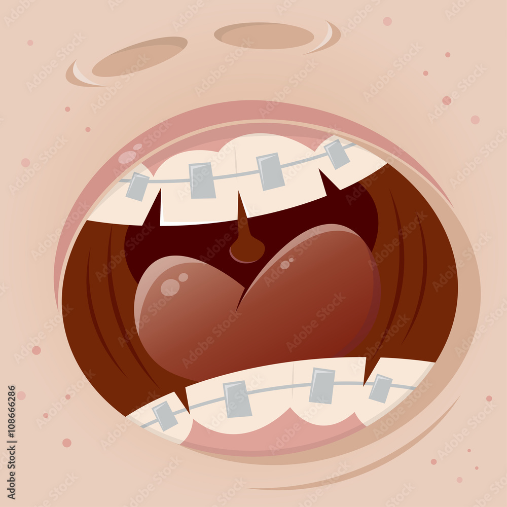 braces mouth cartoon funny clipart Stock Vector | Adobe Stock