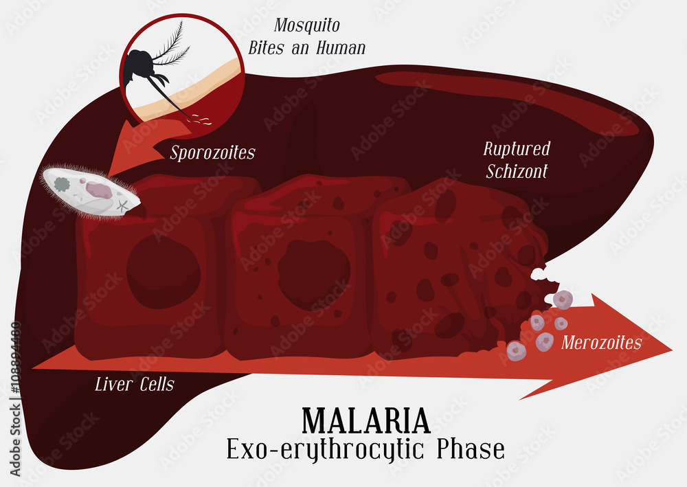 Malarian Plasmodium Life Cycle: Liver Infection, Vector Illustration ...