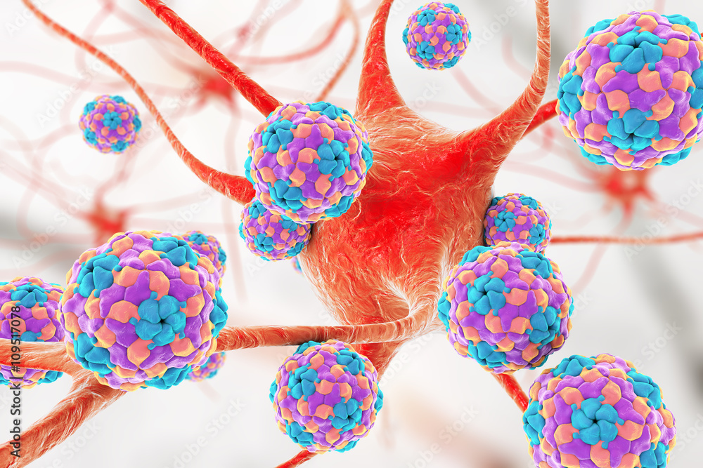 Human Parechoviruses affecting neuron, 3D illustration. Parechoviruses ...
