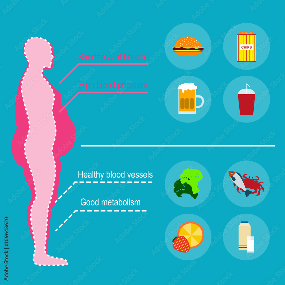 Obesity man. The causes of obesity. Vector illustration. Concept of ...