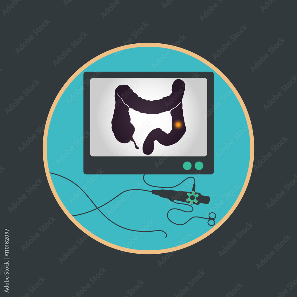 Colonoscopy procedure used for screening colon diseases Stock Vector ...