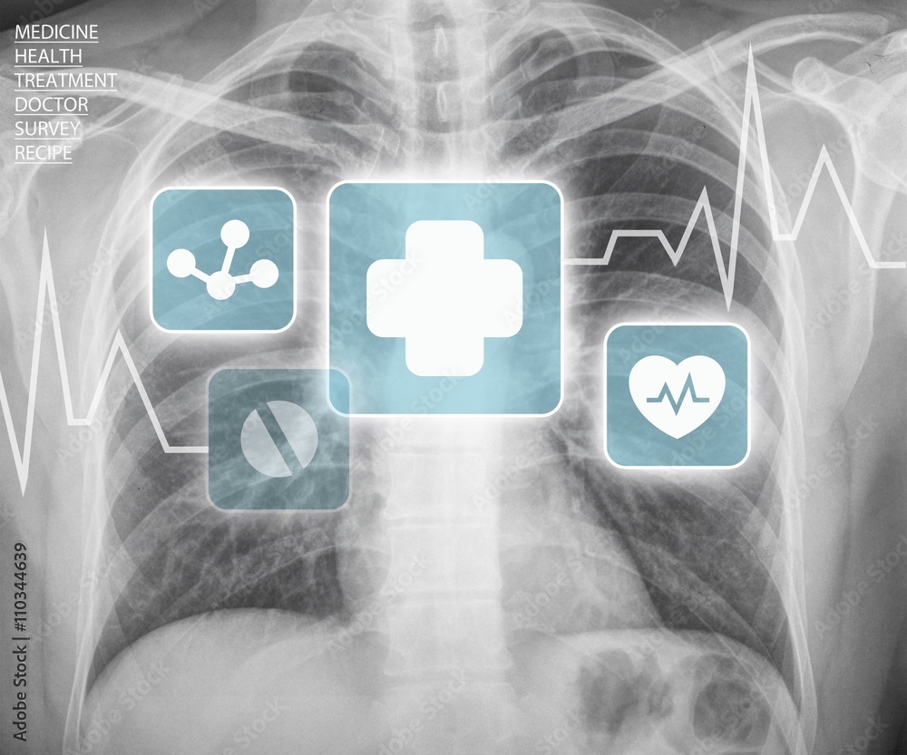 X-ray Image. Stock Photo | Adobe Stock