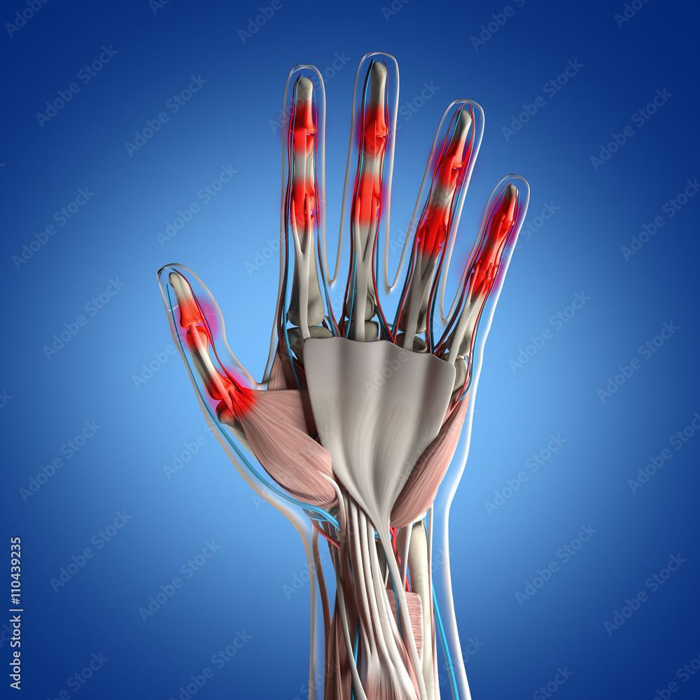 Human anatomy hand palm, joint pain in fingers. 3D Illustration. Stock ...