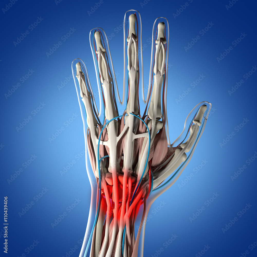 Human anatomy hand, arthritis, joint pain in wrist. 3D Illustration ...